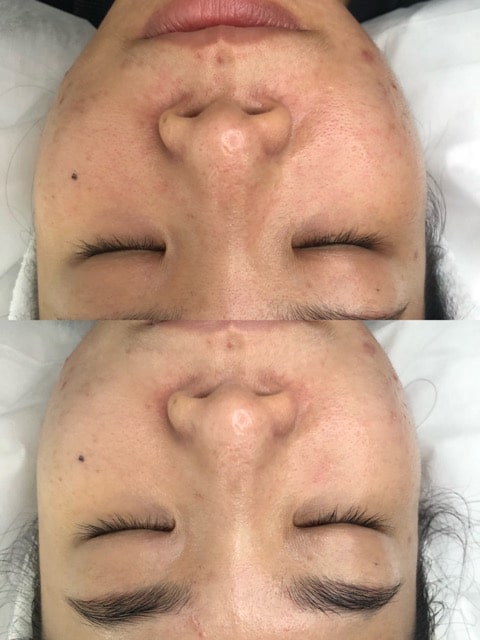 skincare