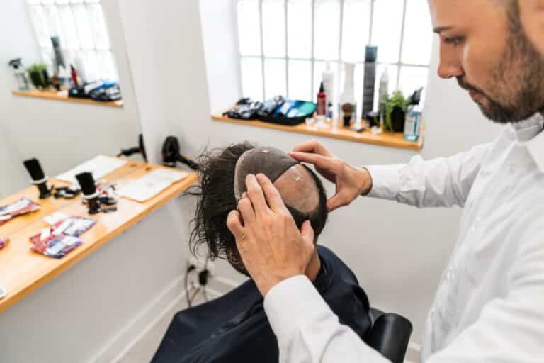 What is the Difference Between SMP and Hair System?